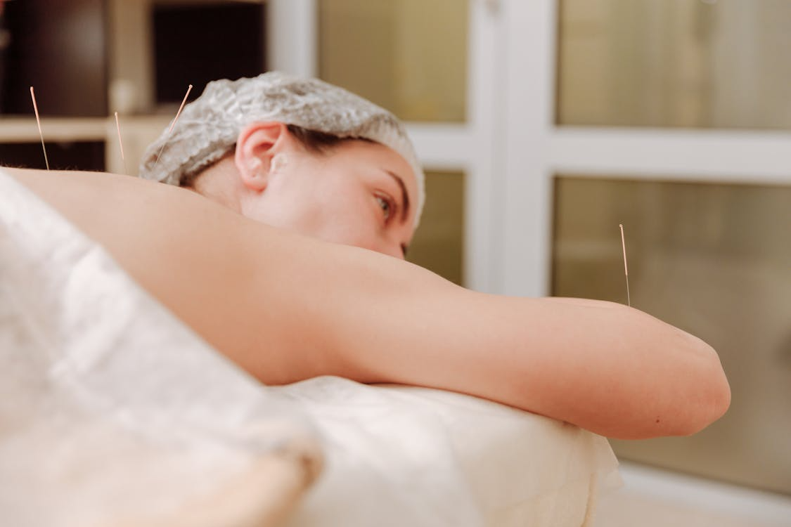 Integrating Acupuncture into Modern Healthcare - Marlborough House